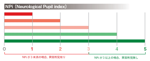 瞳孔記録計 NPi-100 「ペンライトから数値診断へ」｜医療従事者向けWEBマガジン int イント | アイ・エム・アイ株式会社 IMI ...